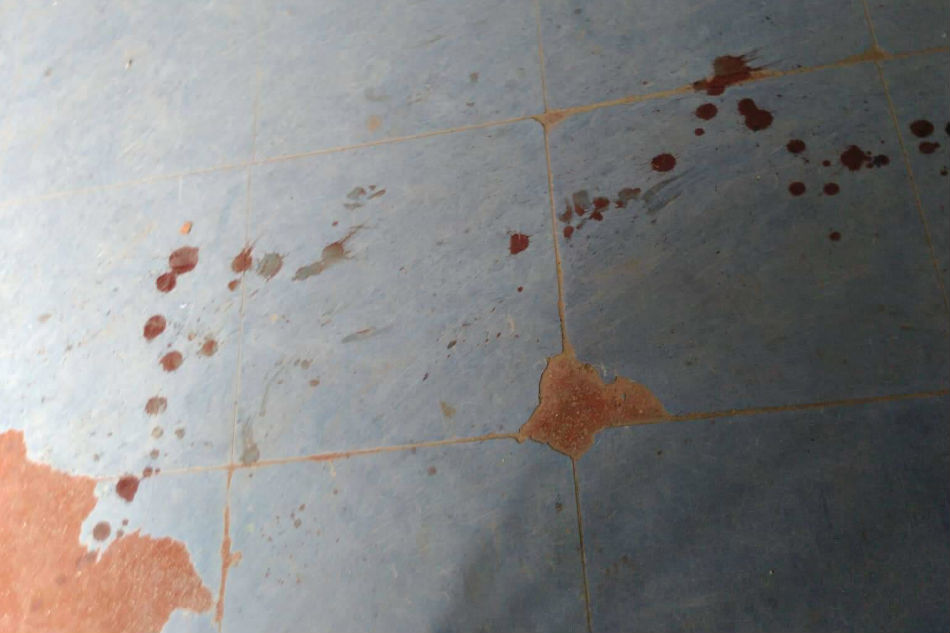 Nililinis na baril, aksidenteng pumutok; 2 pulis sugatan | ABS-CBN News Nililinis na baril, aksidenteng pumutok; 2 pulis sugatan | ABS-CBN News